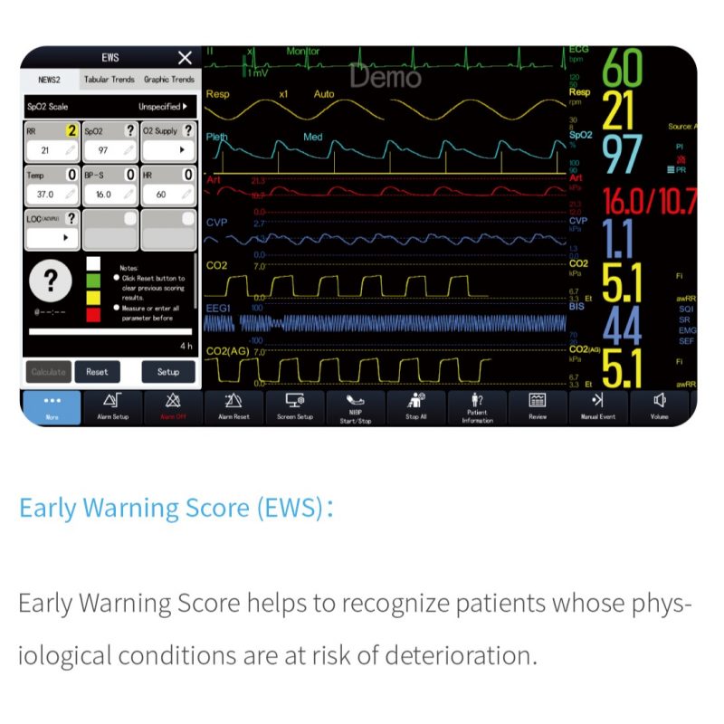 NMPro Series Patient Monitors | Comen Medical Monitors
